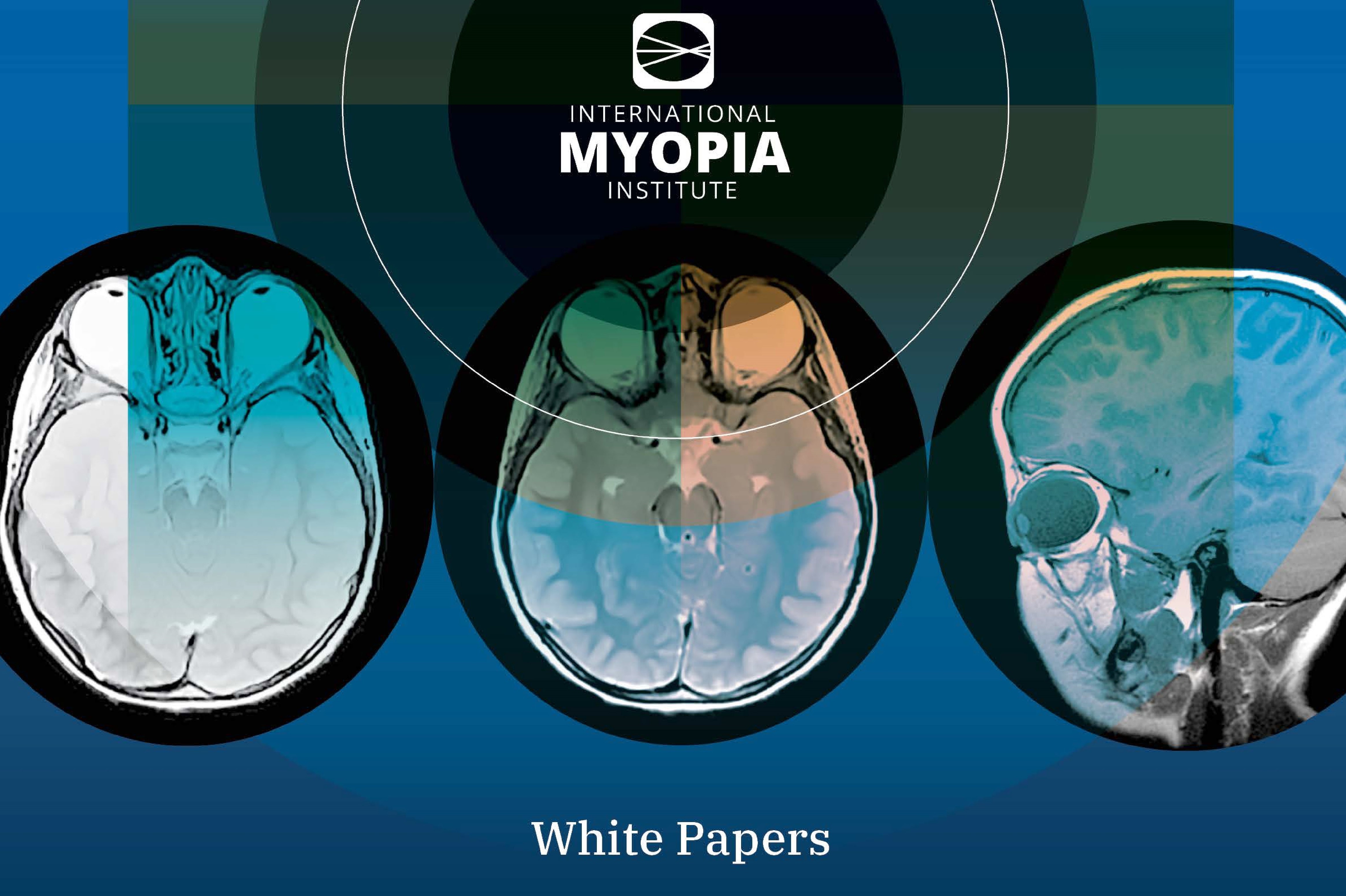 IMI names new taskforce chairs