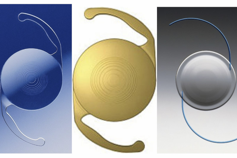 IOL constants database ready for use - nzoptics
