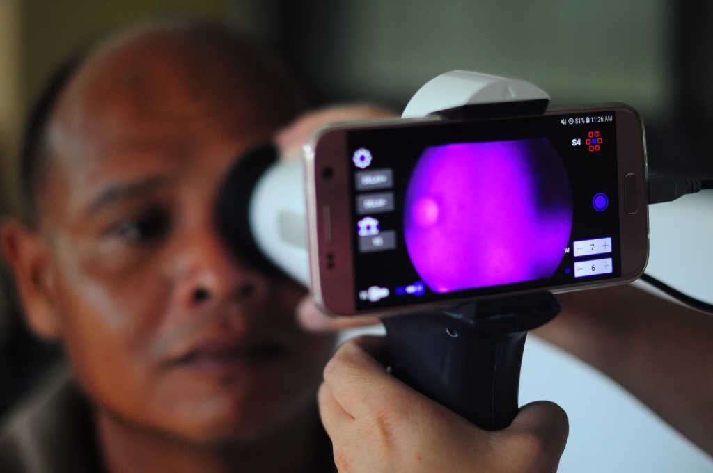 Teleophthalmology tech goes global - nzoptics