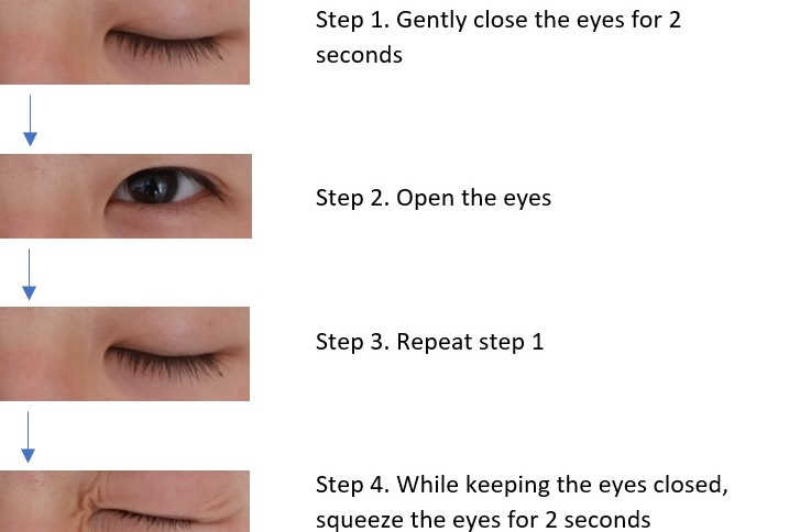 Blinking exercises can make a difference! - eyeonoptics