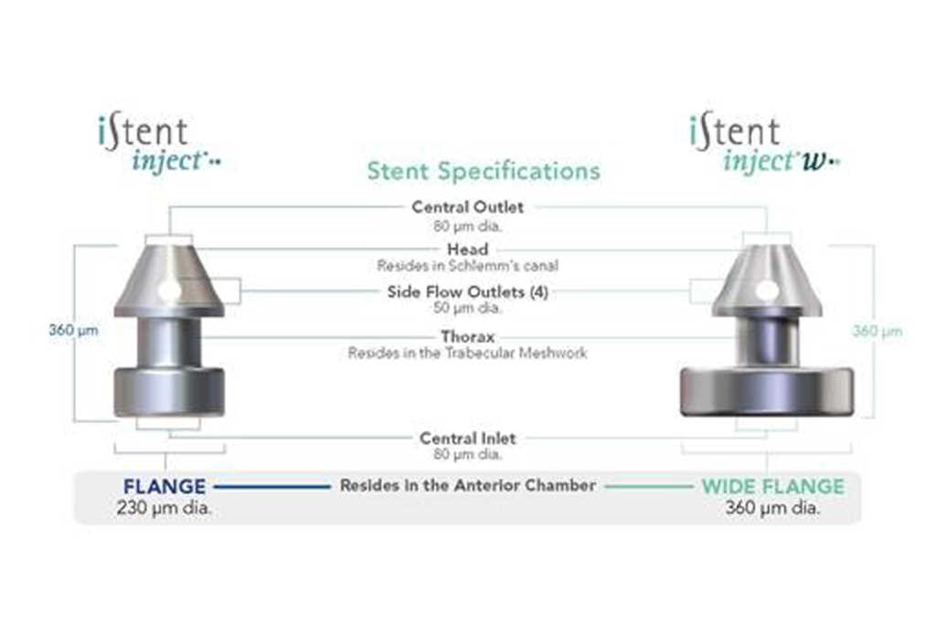 The iStent evolves - eyeonoptics