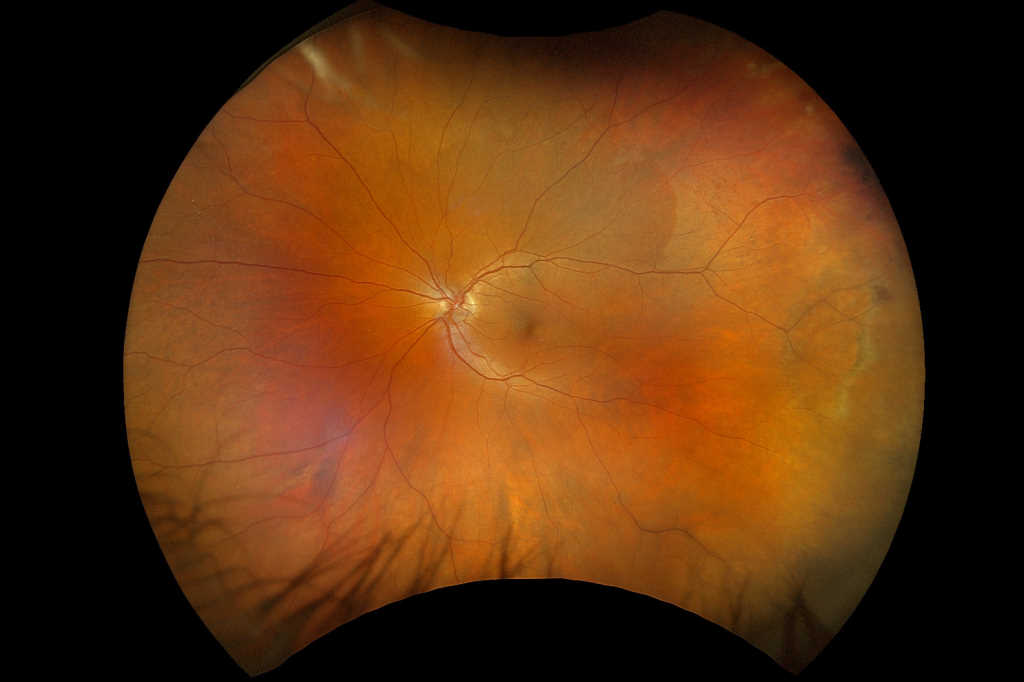 Ultra-widefield, now in colour - nzoptics