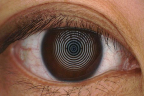 Identifying inflammation in dry eye disease - nzoptics