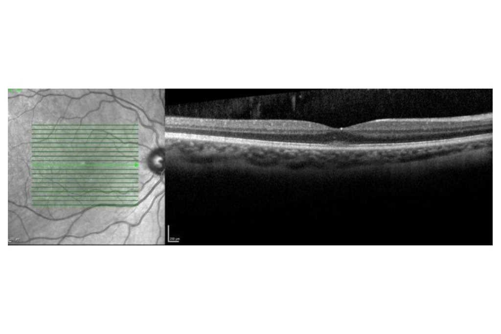 CASE STUDY: For eyes that really pop…
