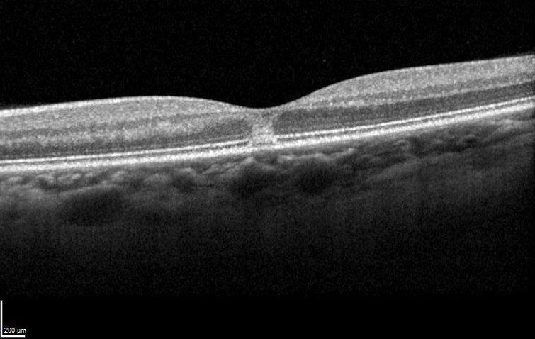 CASE STUDY: For eyes that really pop…