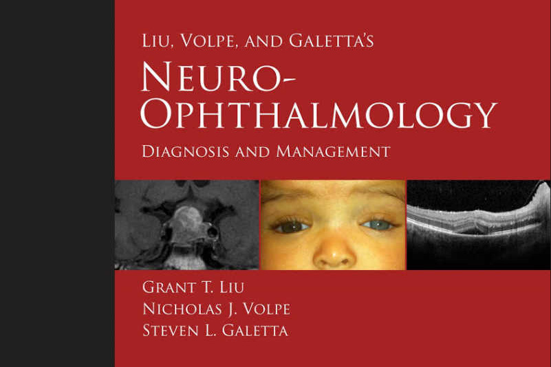 Book review: Liu, Volpe, and Galetta’s Neuro-Ophthalmology: Diagnosis ...